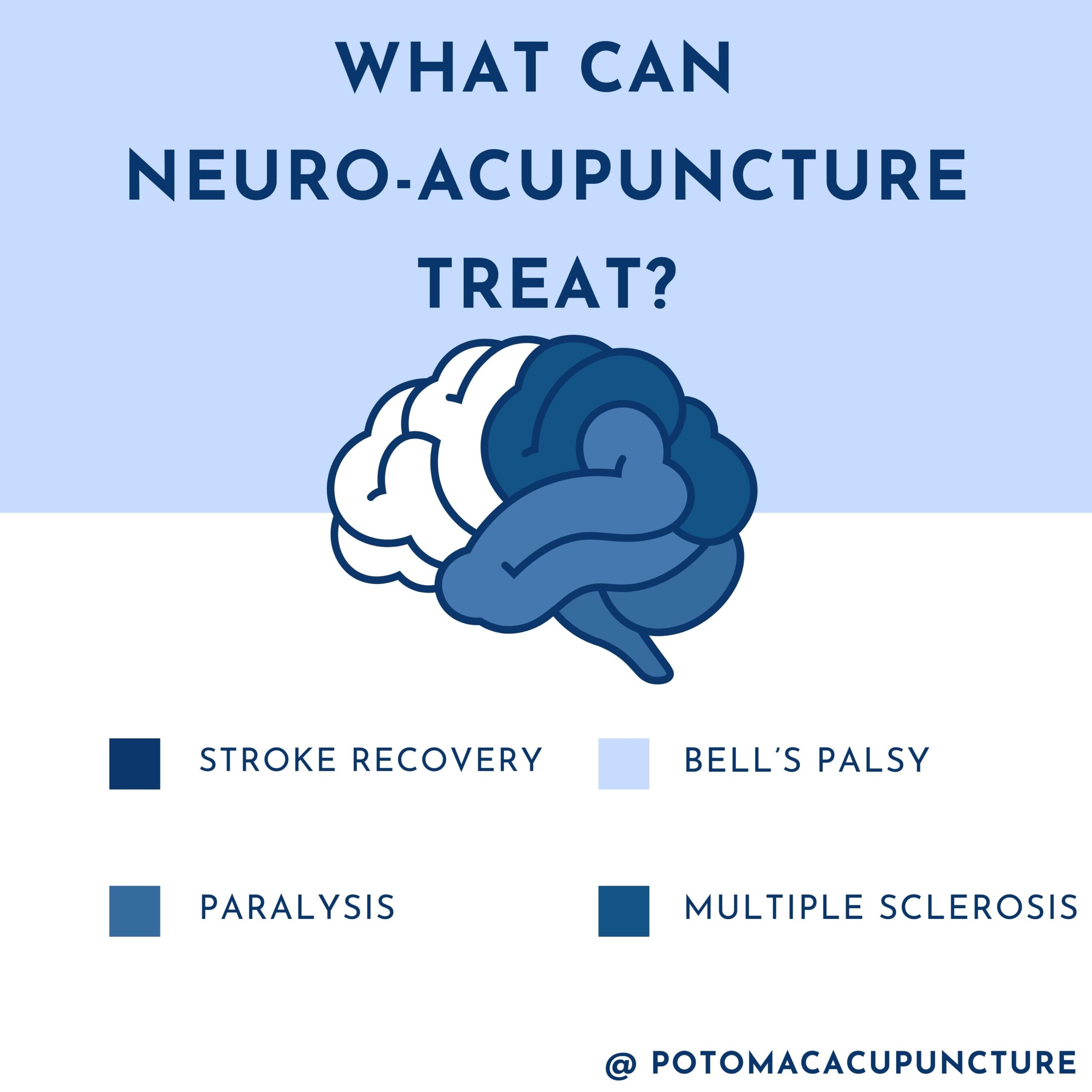 What can Neuro-Acupuncture treat? - Potomac Acupuncture & Wellness